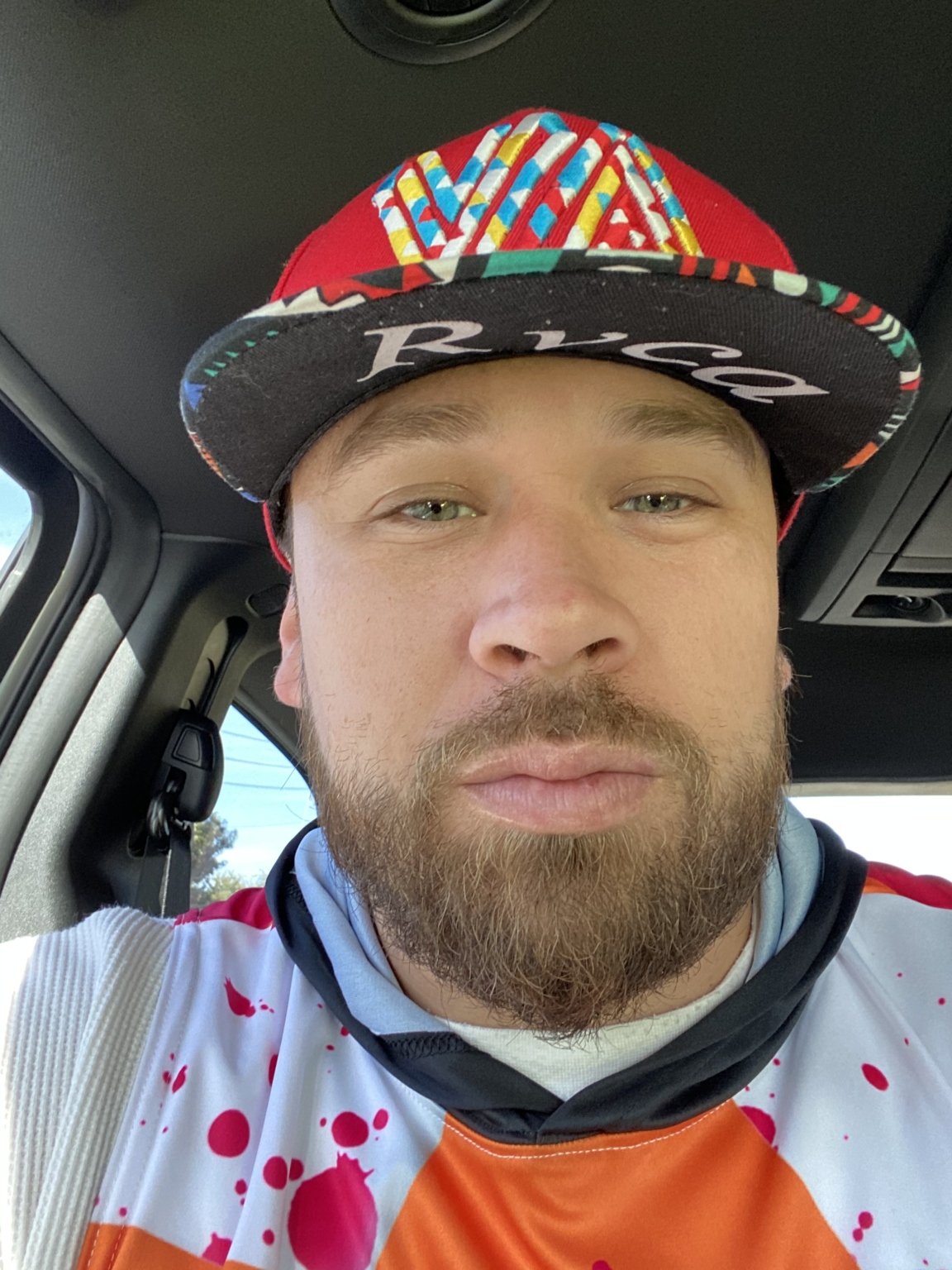 Yesid Sanchez – Done Deal